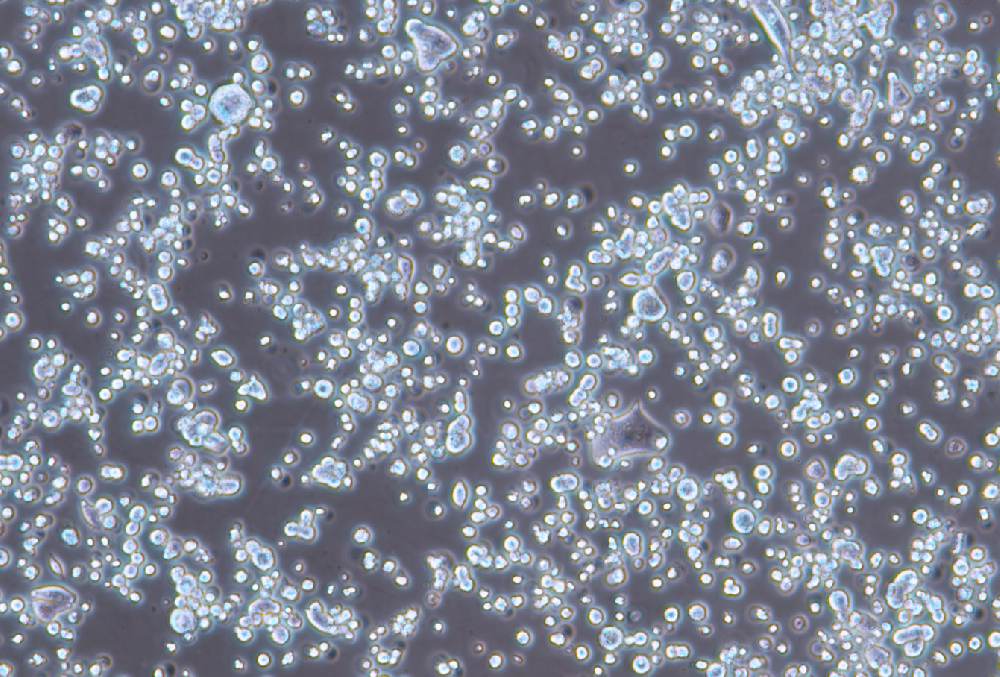 人结直肠腺癌细胞COLO320DM(STR鉴定正确)-细胞系-广州科梵生物技术有限公司