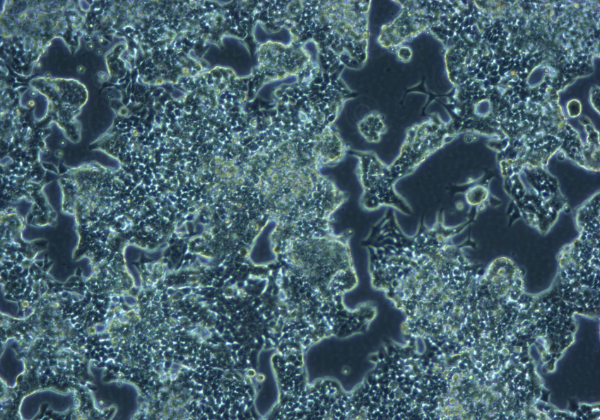 人子宫内膜癌细胞RL95-2(STR鉴定正确)-细胞系-广州科梵生物技术有限公司