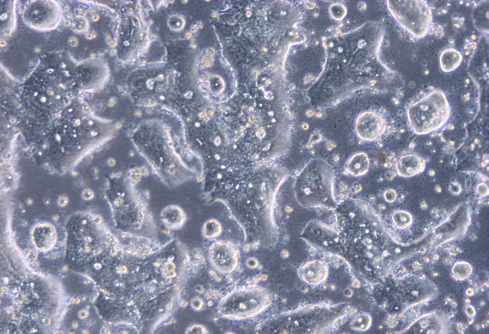 人结肠腺癌细胞SW948(STR鉴定正确)-细胞系-广州科梵生物技术有限公司